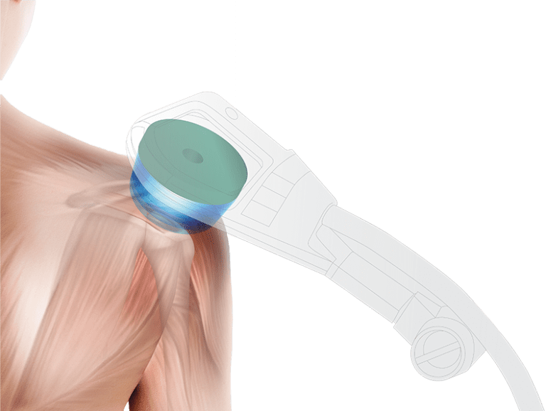 Super Inductive System | ISOMATIC Integrative Health Centre